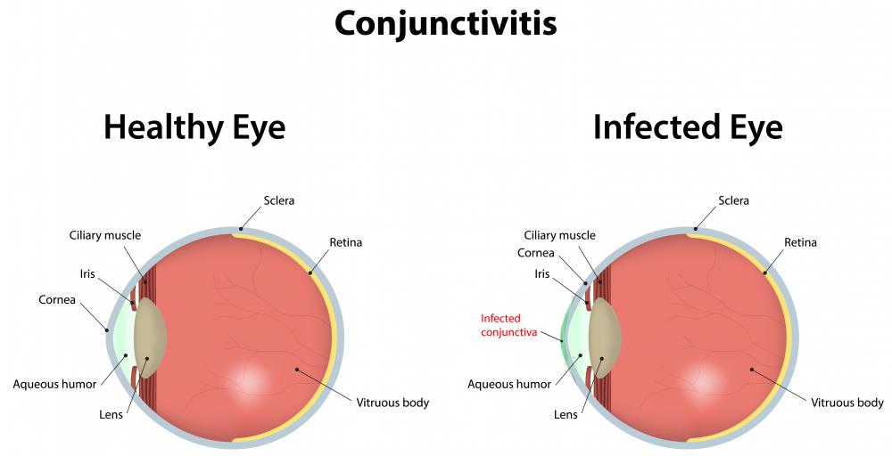 Bulbar Conjunctiva Diagram