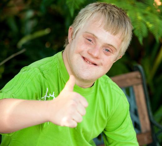 What Is Mosaic Down Syndrome with Pictures 